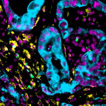 MD Anderson Newsroom | MD Anderson Cancer Center