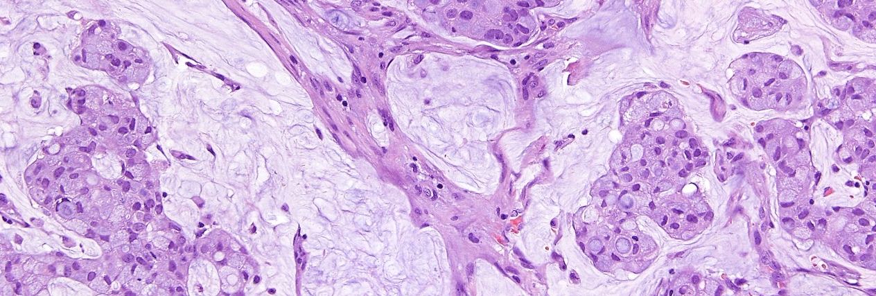 Pathology Department | MD Anderson Cancer Center