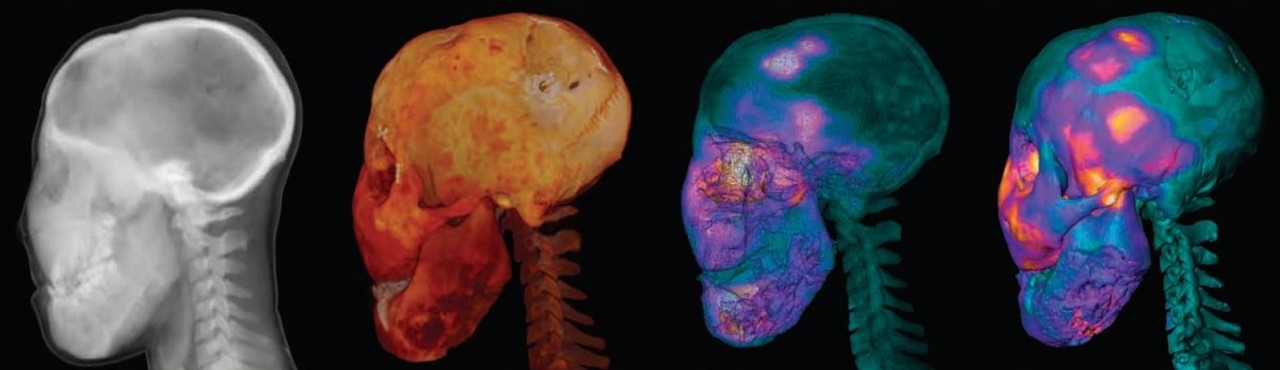 Department of Imaging Physics | MD Anderson Cancer Center