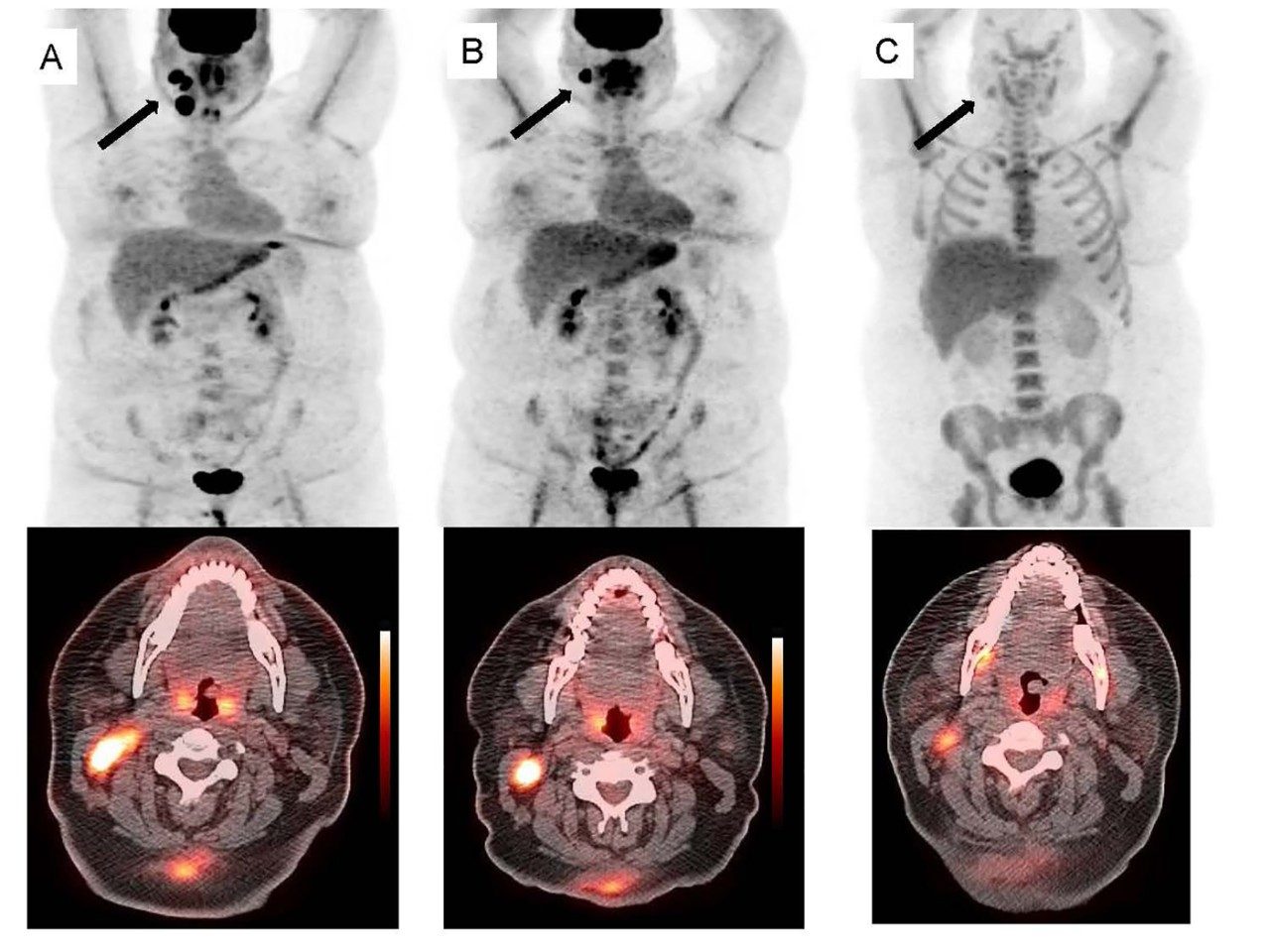 Nuclear Medicine Current Research | MD Anderson Cancer Center