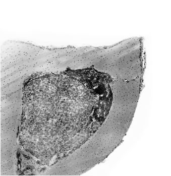 Bone Metastasis Laboratory | MD Anderson Cancer Center