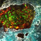 Bone Metastasis Laboratory | MD Anderson Cancer Center