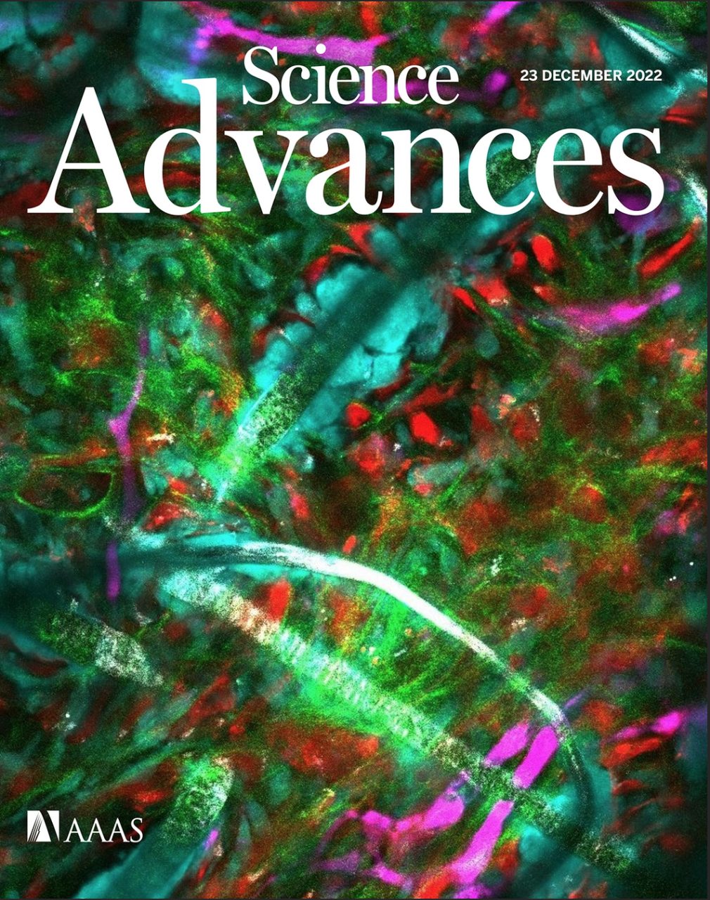 Bone Metastasis Lab Publications | MD Anderson Cancer Center