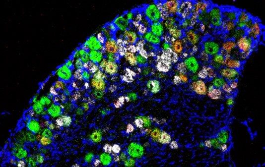 Grace Lab Research | MD Anderson Cancer Center