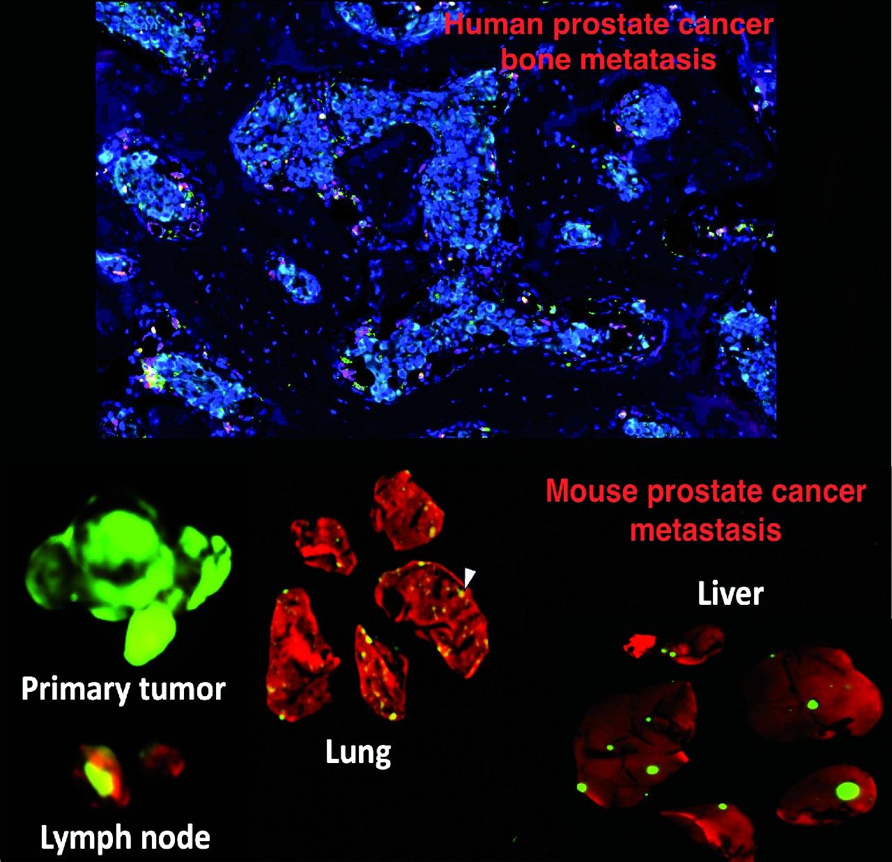 Guocan Wang Lab Research | MD Anderson Cancer Center