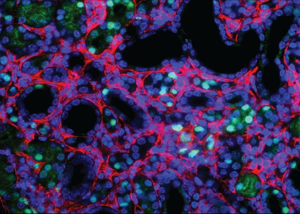 Kalluri Lab, Cancer Research | MD Anderson Cancer Center