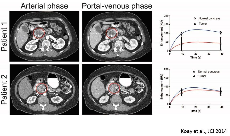 Cancer Physics and Engineering Lab | MD Anderson Cancer Center