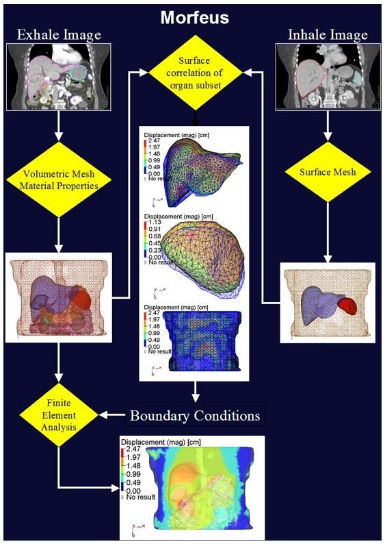 Morfeus Lab | MD Anderson Cancer Center