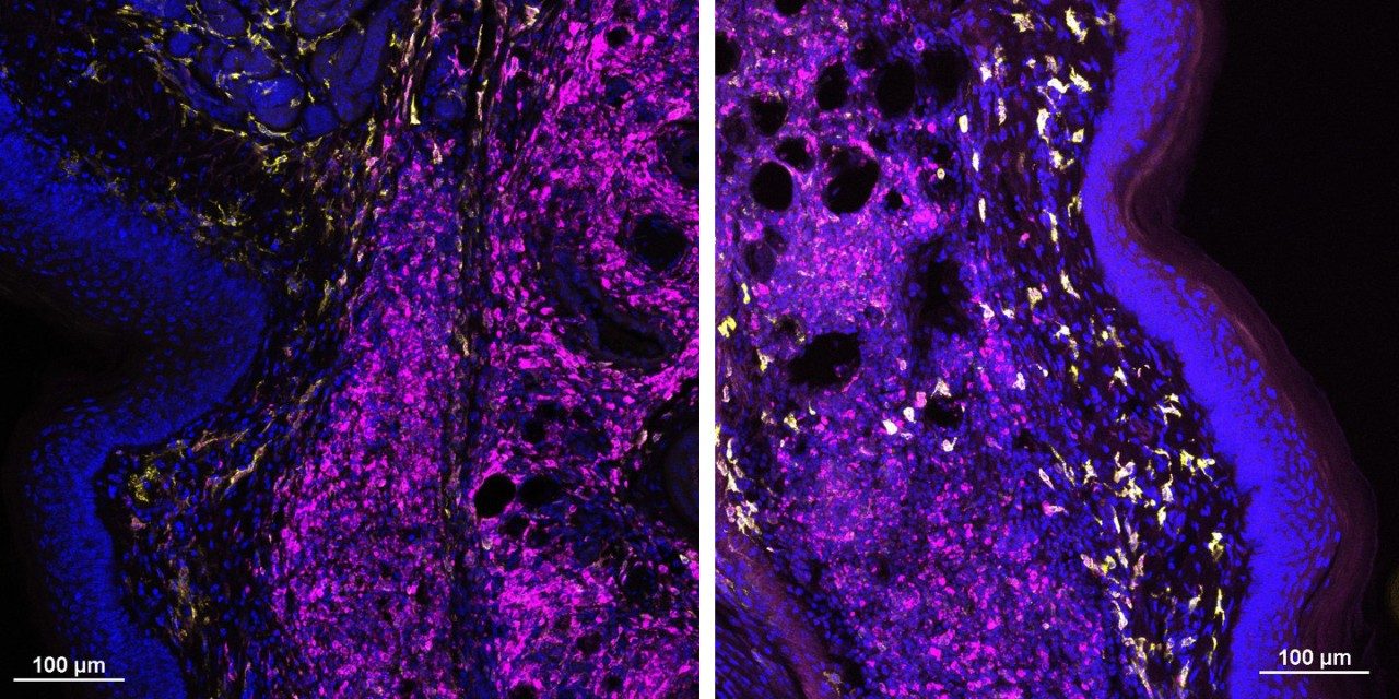 Shepherd Lab Research | MD Anderson Cancer Center
