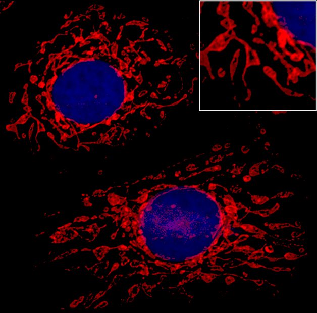 Advanced Microscopy Core Gallery | MD Anderson Cancer Center