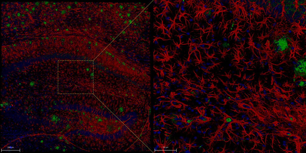 Advanced Microscopy Core Gallery | MD Anderson Cancer Center