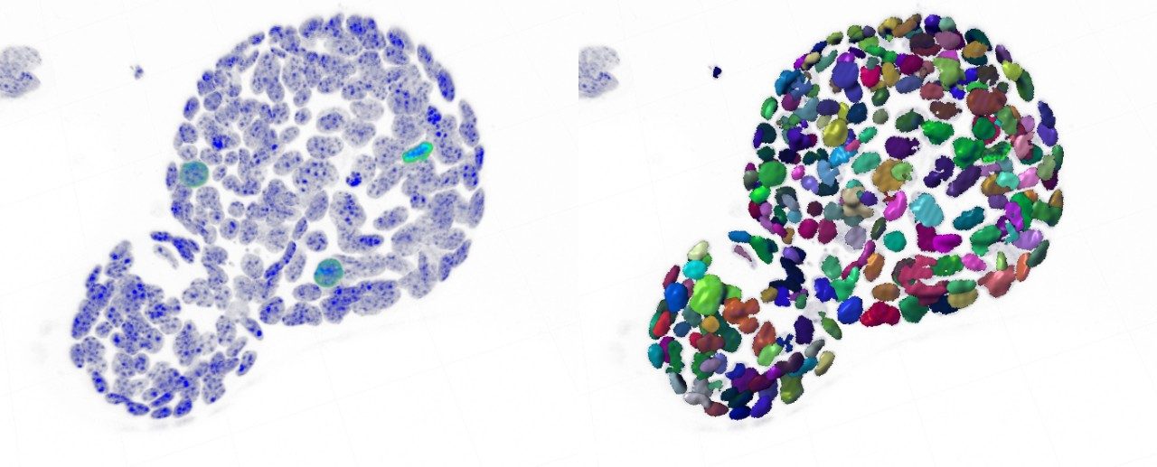 Advanced Microscopy Core Gallery | MD Anderson Cancer Center