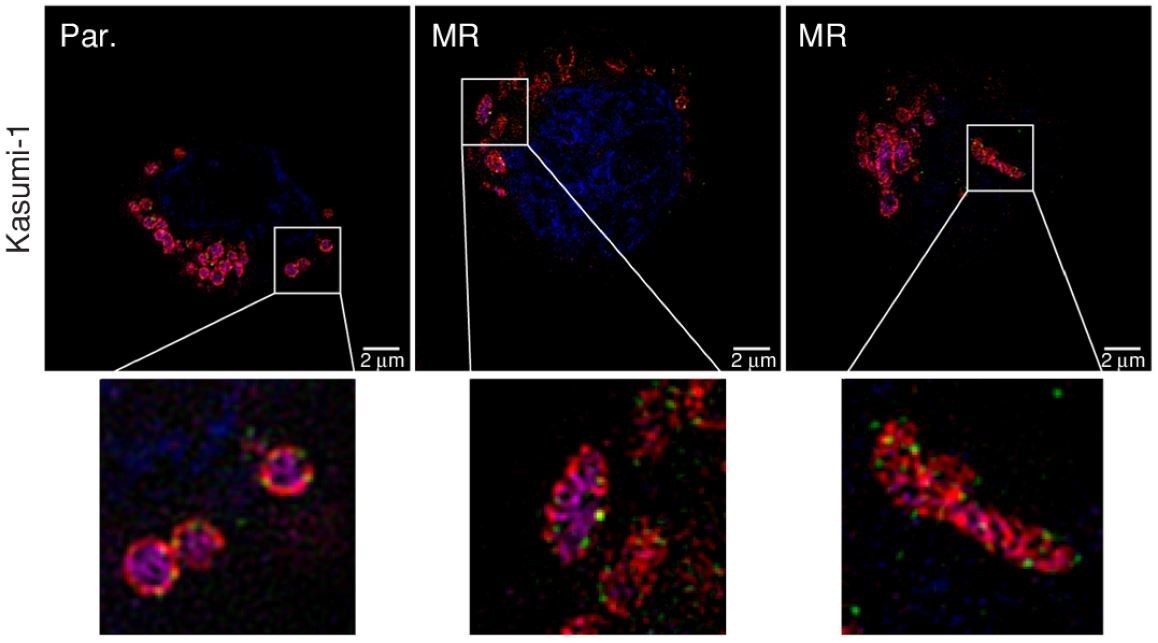 Advanced Microscopy Core Gallery | MD Anderson Cancer Center
