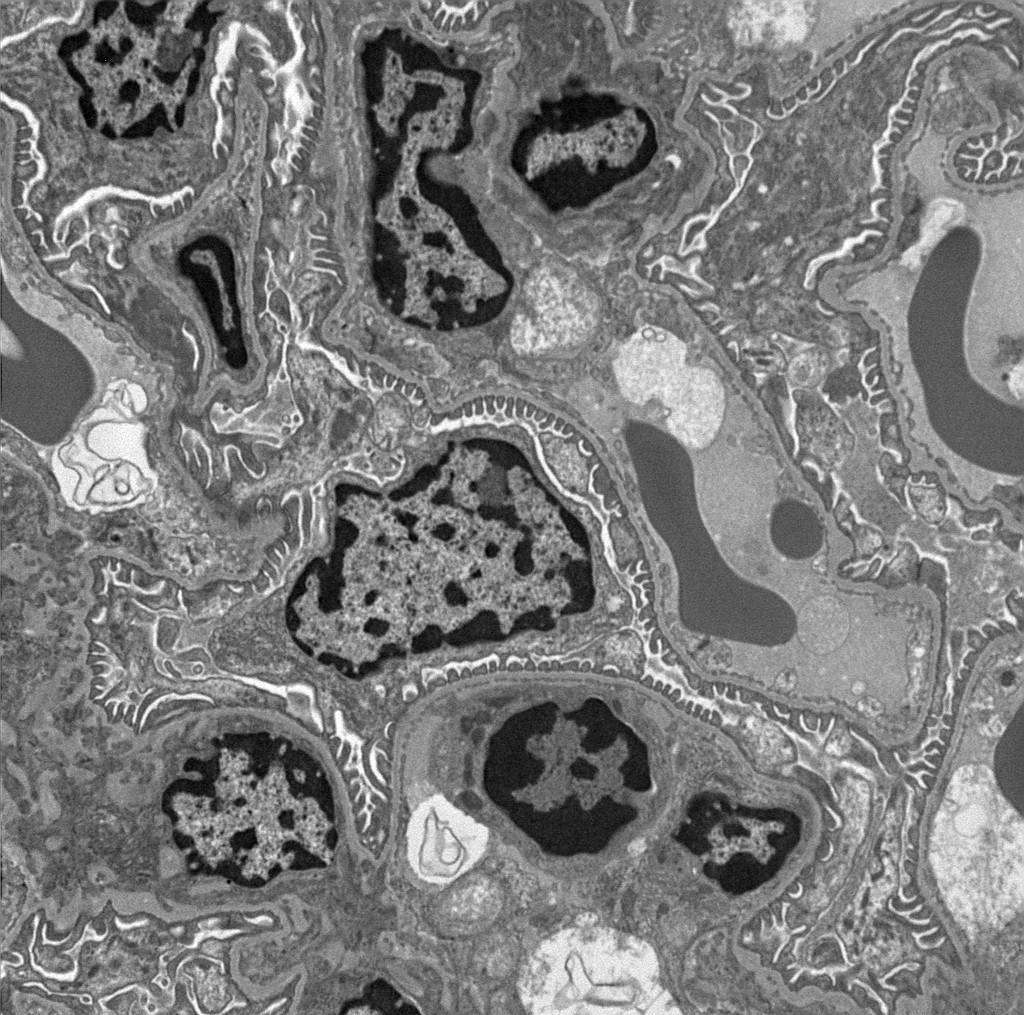 High Resolution Electron Microscopy Facility | MD Anderson Cancer Center