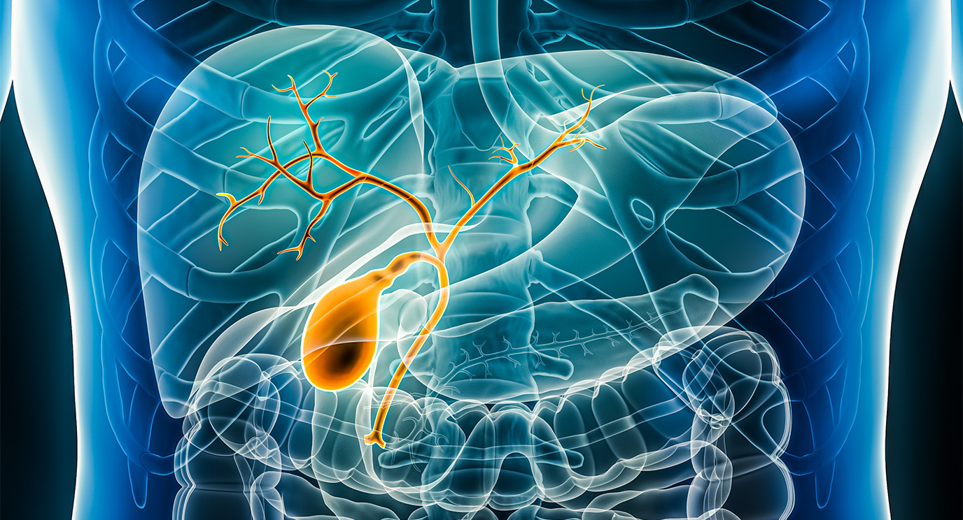 ASCO: Targeted therapy induces responses in HER2-amplified biliary ...