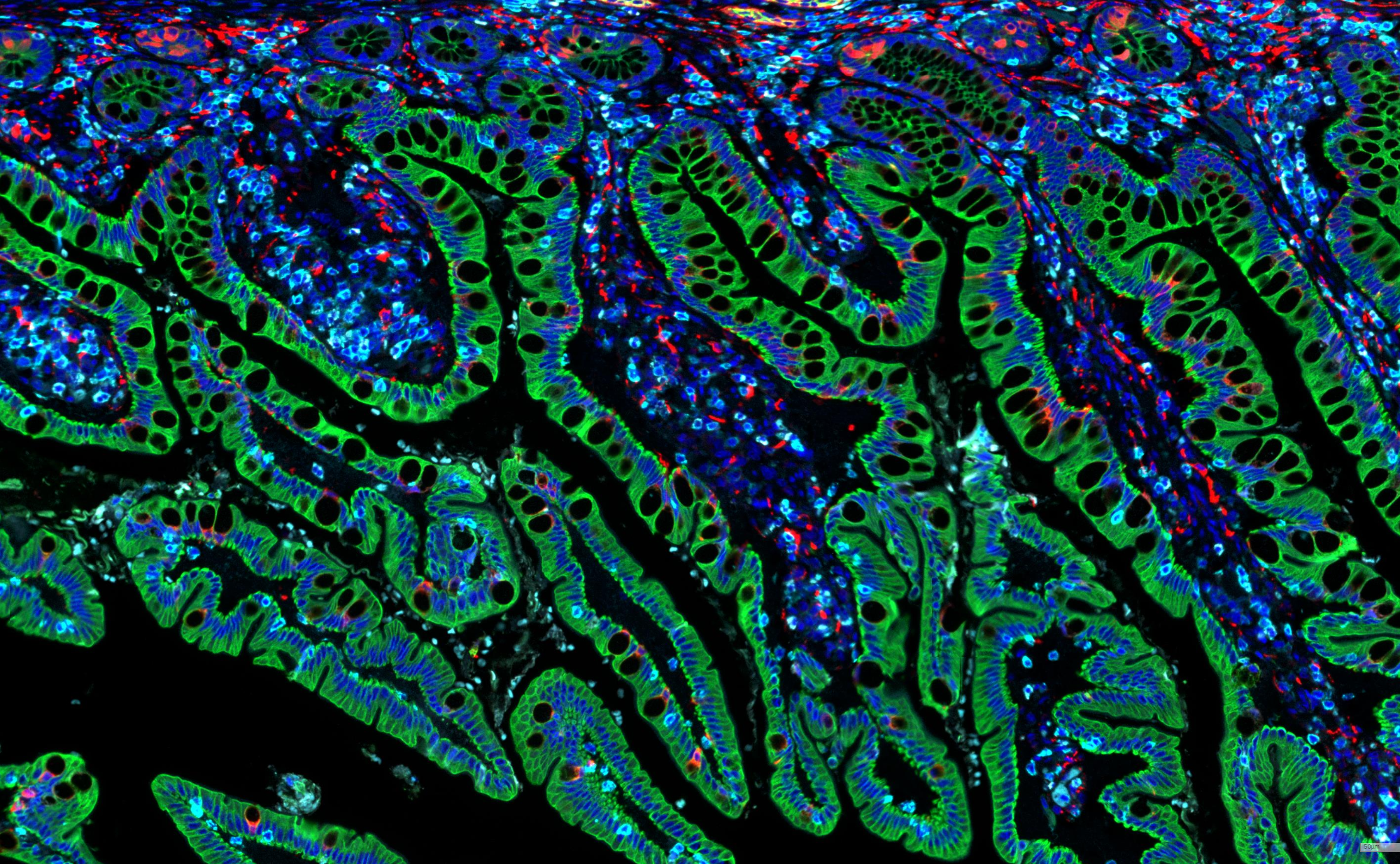 MD Anderson and Nature to co-host conference on the tumor ecosystem ...