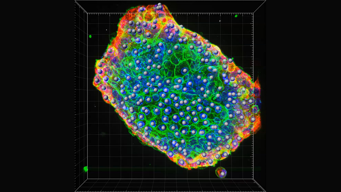 MD Anderson Research Highlights for November 3, 2022 | MD Anderson ...