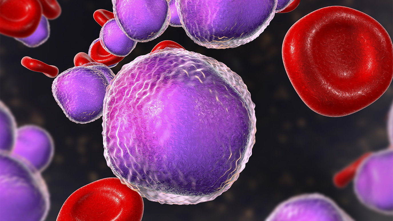 Adolescent and young adult leukemia survivors have shorter life span ...