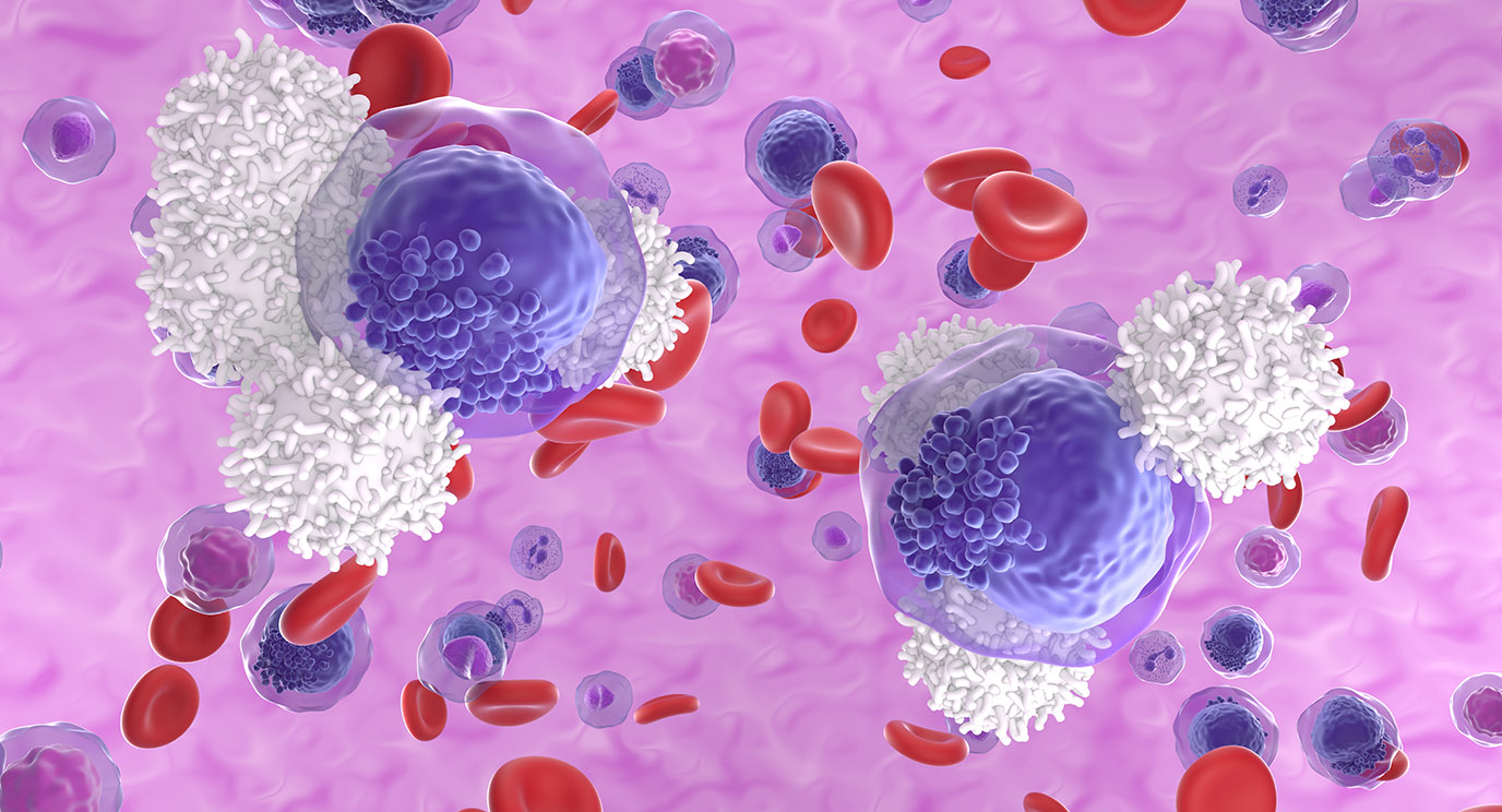 MD Anderson Research Highlights: ASH 2023 Special Edition | MD Anderson ...