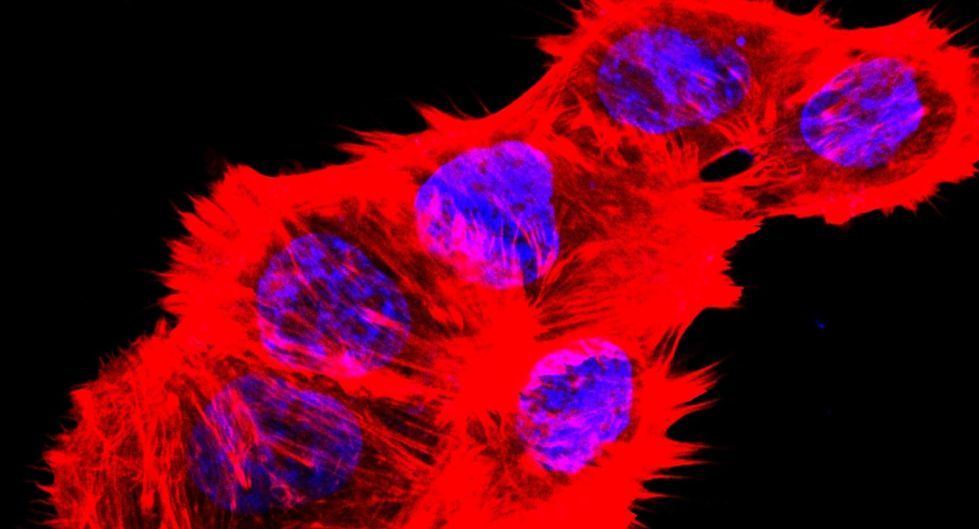 New cell death mechanism could offer novel cancer treatment strategies ...