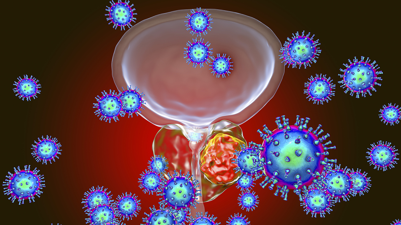 Immunotherapy effective in metastatic prostate cancers with specific ...