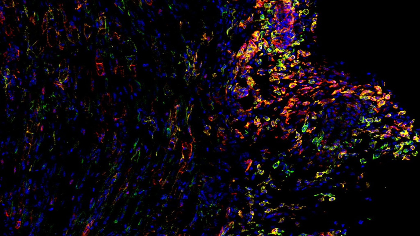Researchers identify novel therapeutic target to improve recovery after ...