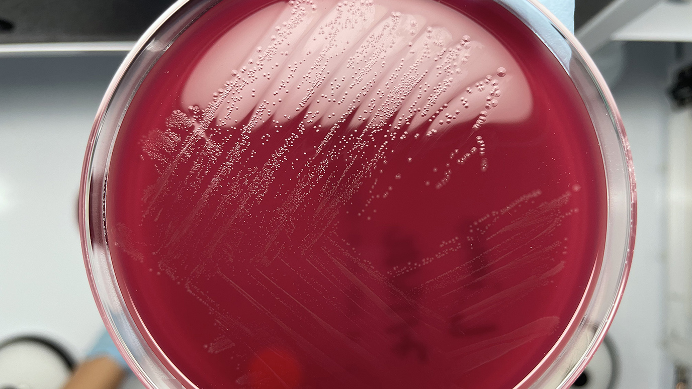 Lactate-producing bacteria inside tumors promote resistance to ...