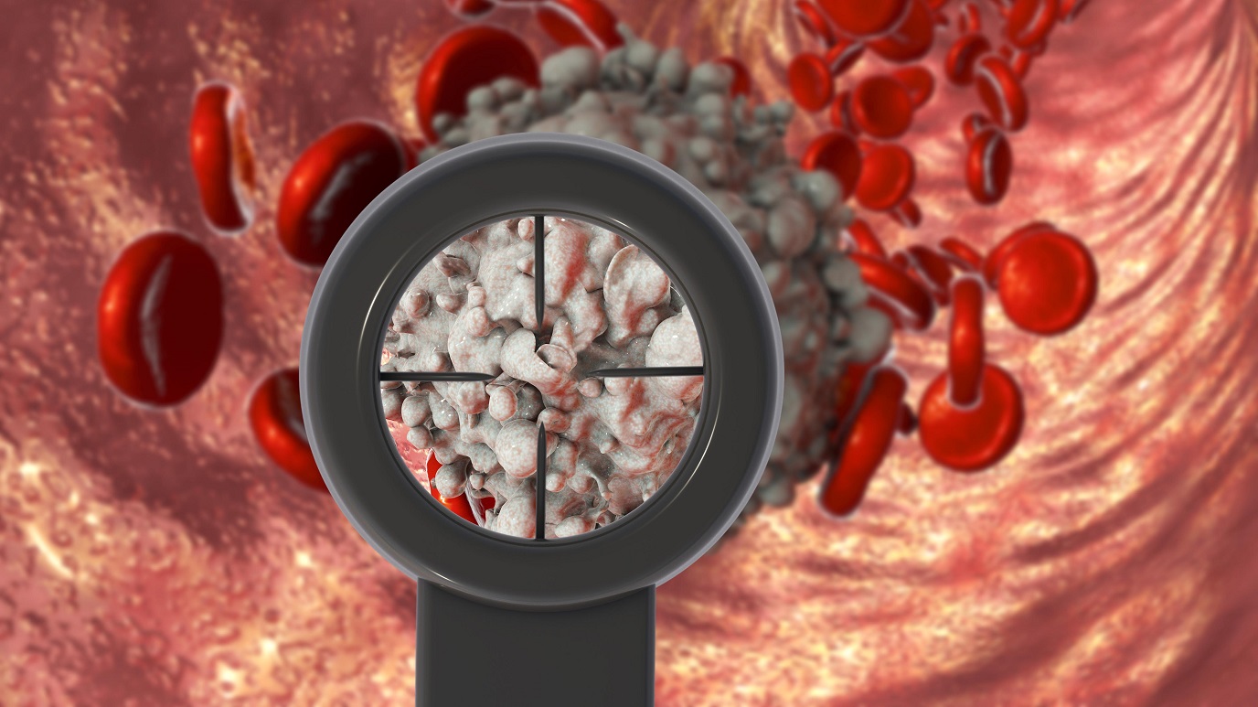 Novel antibody-drug conjugate shows promising early results in rare ...