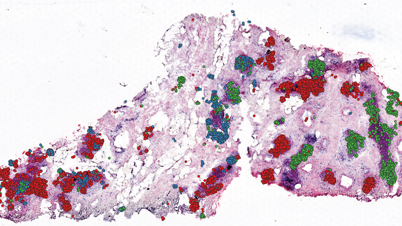 Computational approach enables spatial mapping of single-cell data ...