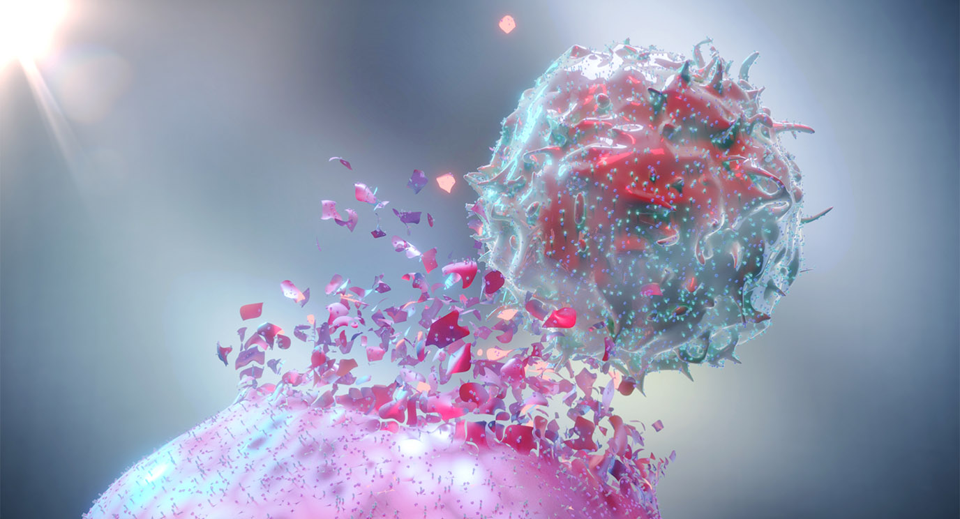 Engineered NK cells can eliminate glioblastoma stem cells | MD Anderson ...