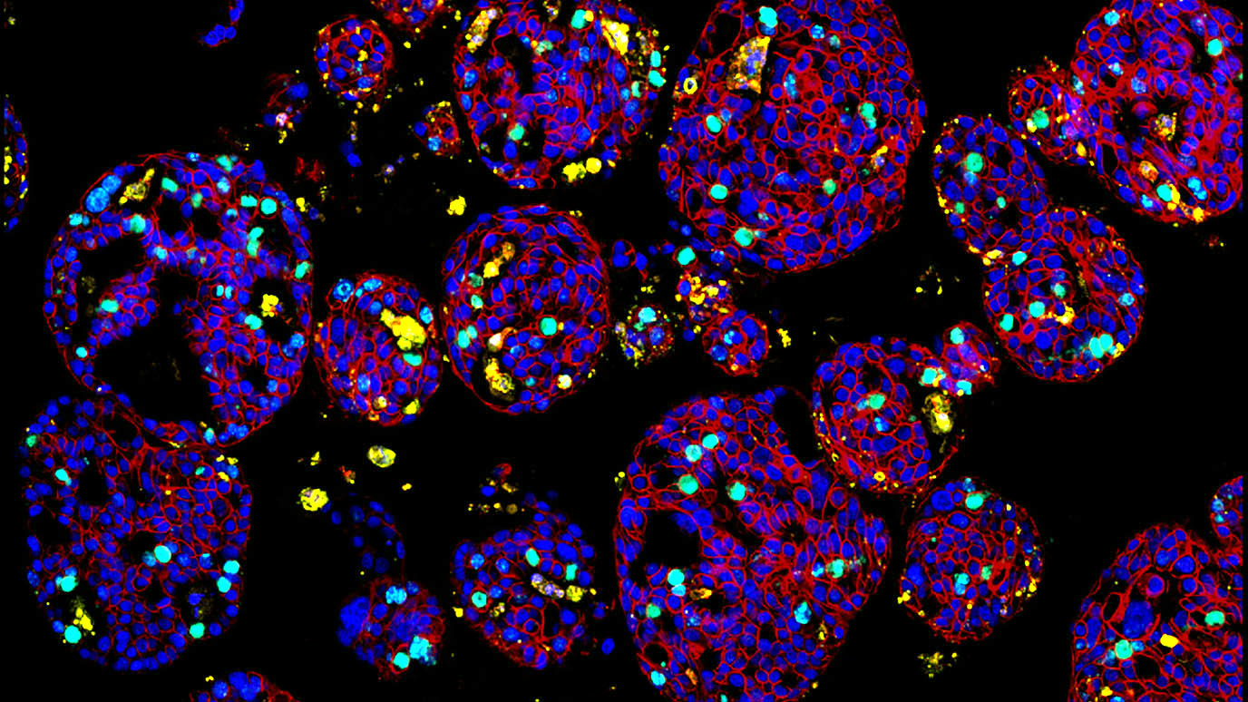 Collaboration to advance technology and cancer therapies from MD ...