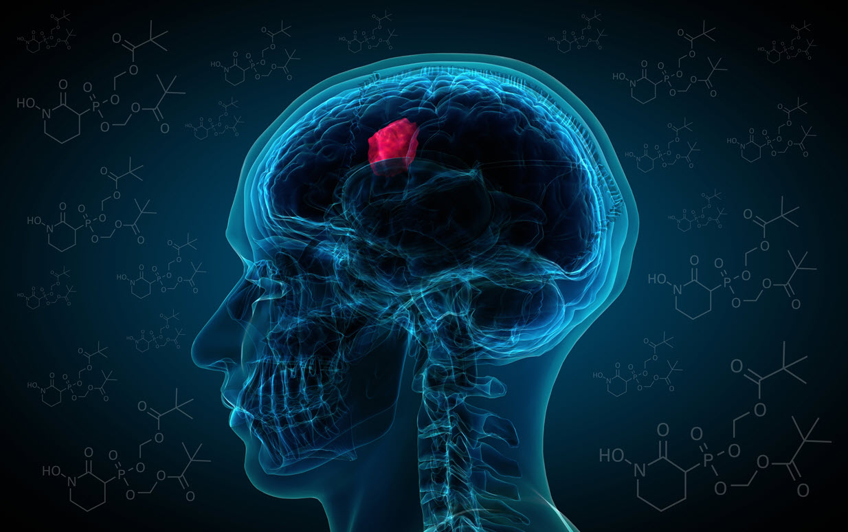 New targeted therapy blocks metabolism in brain cancer cells with ...
