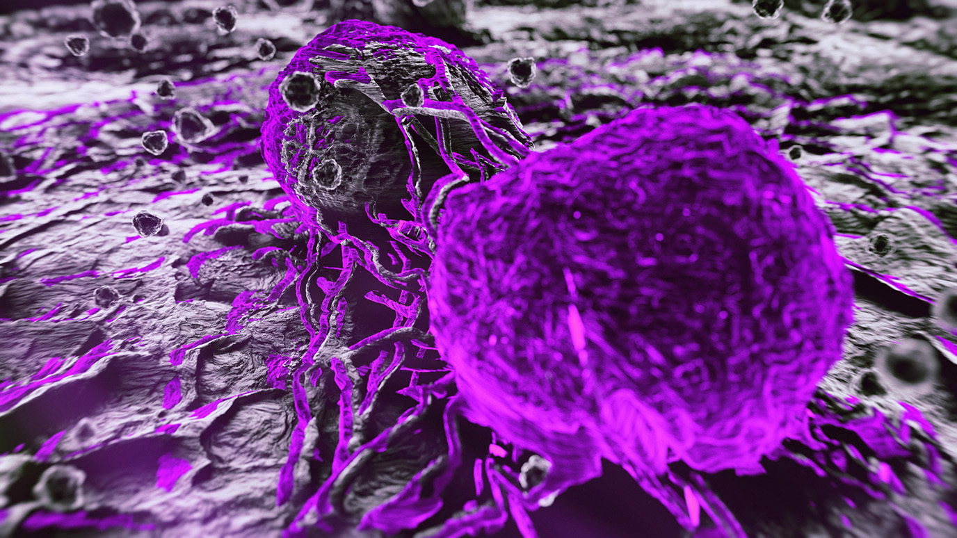 Study supports precision radiation therapy in lung cancer | MD Anderson ...