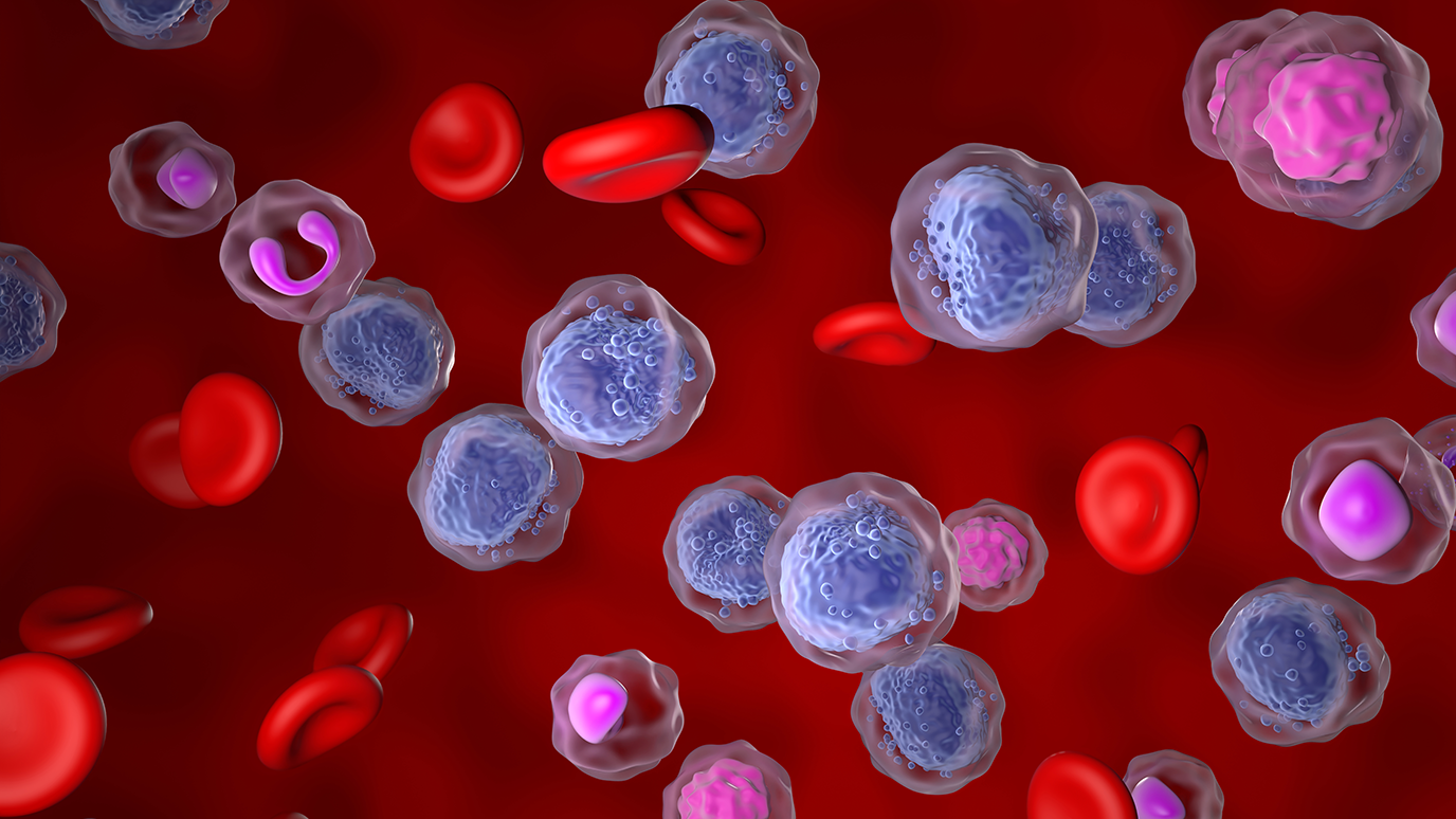 Novel targeted therapy regimens show promise in aggressive AML subtype ...