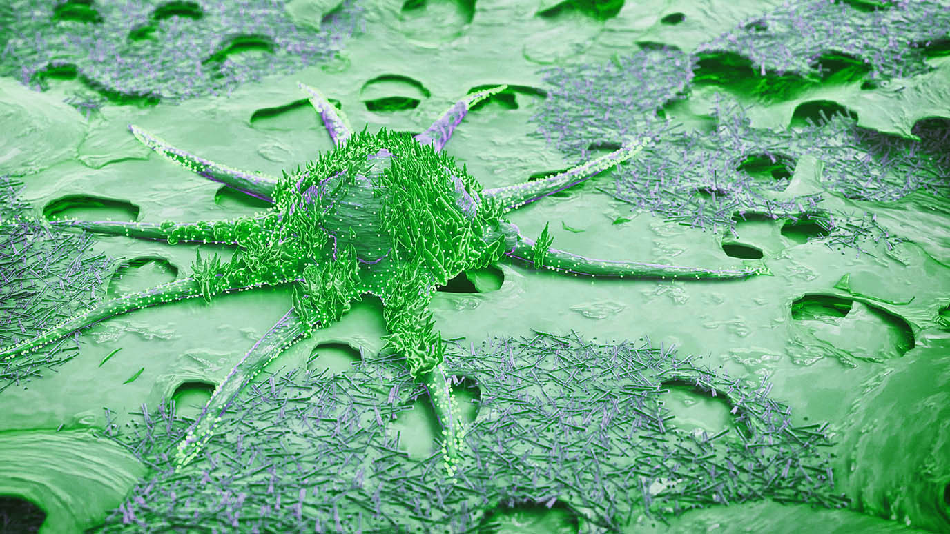 ESMO: Novel ADC AZD8205 demonstrates manageable safety profile and ...