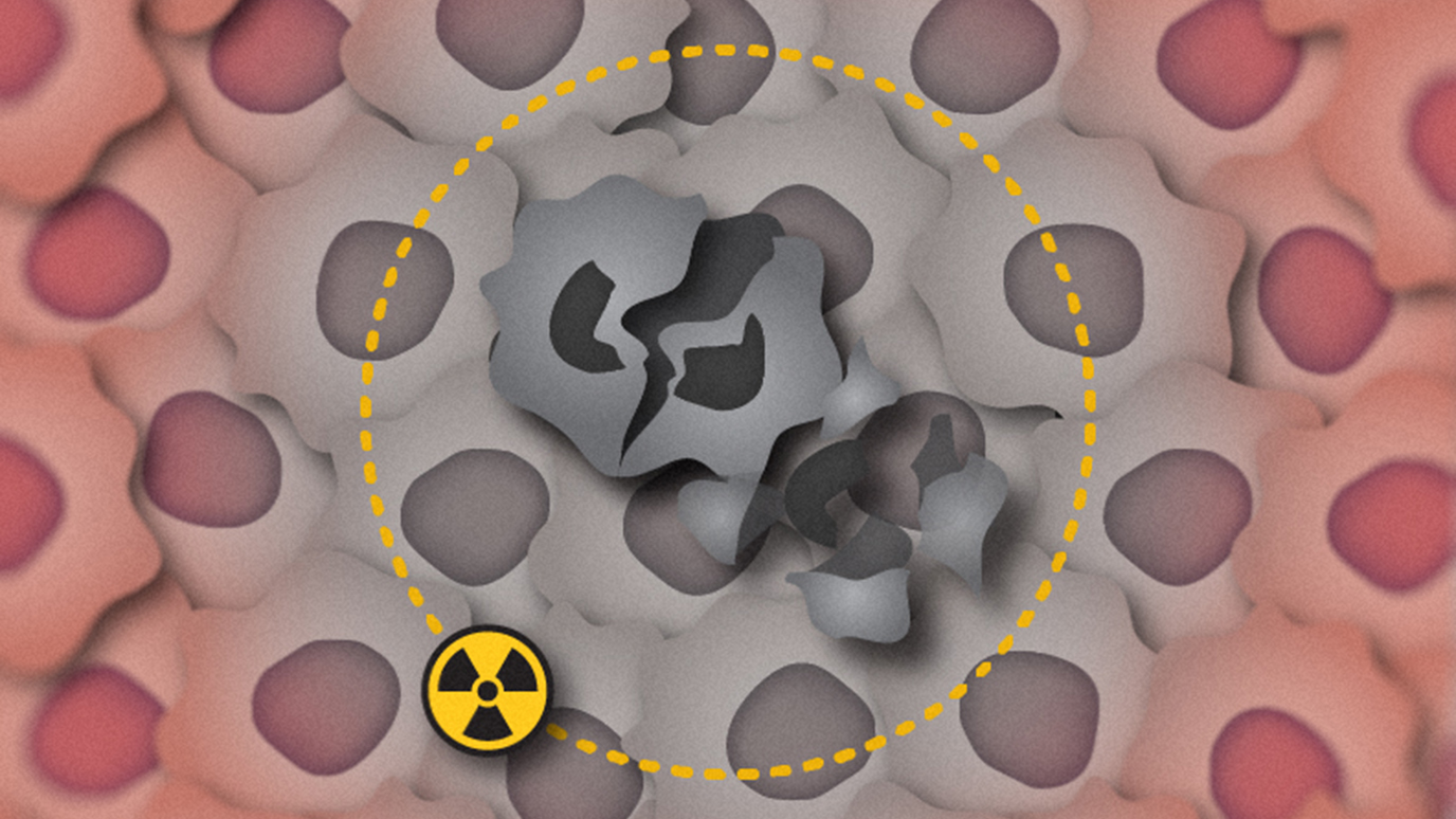 Agents that cause ‘copper overload’ can overcome radiotherapy ...