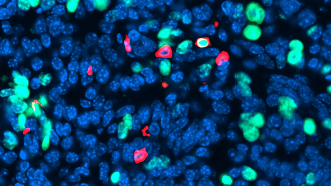 First-in-class pan-KRAS inhibitor shows strong antitumor activity in ...