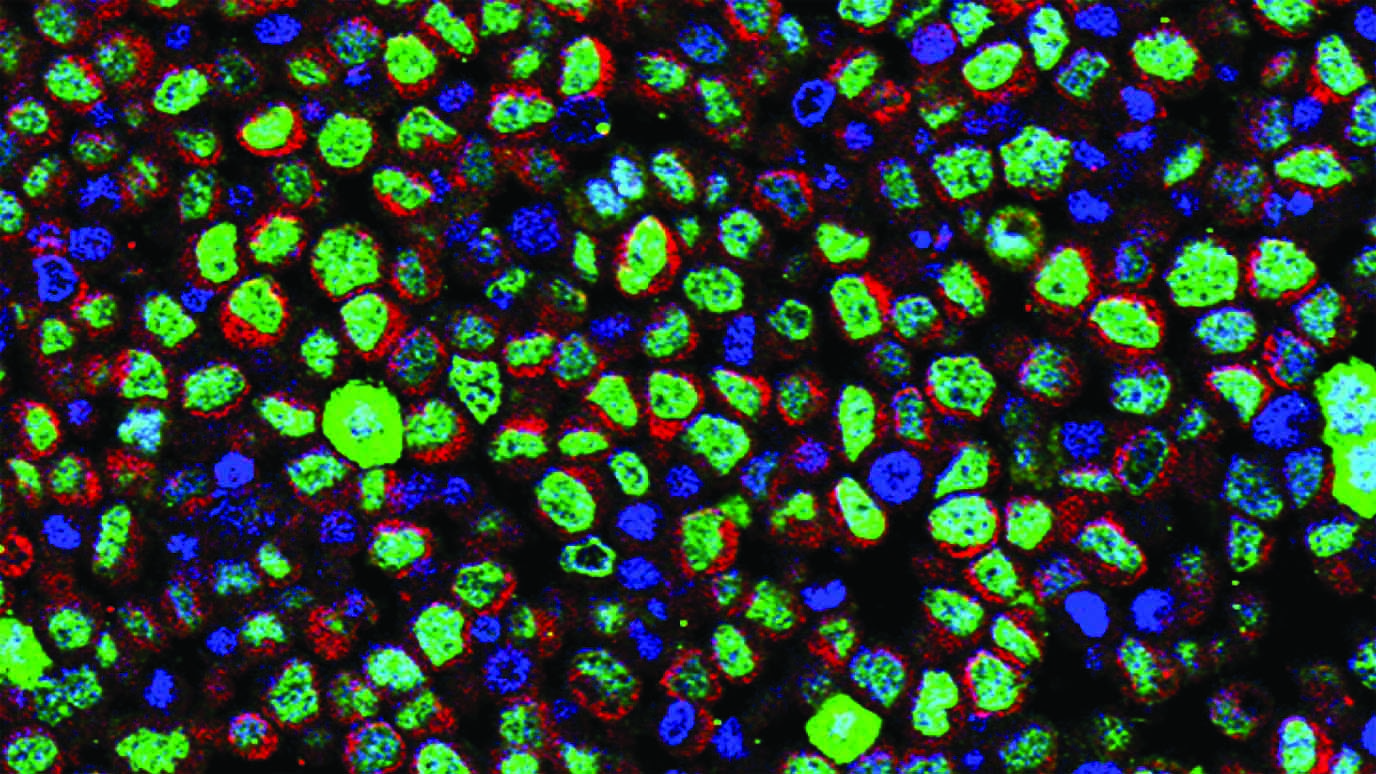 Md Anderson Research Highlights For September 14 2022 Md Anderson