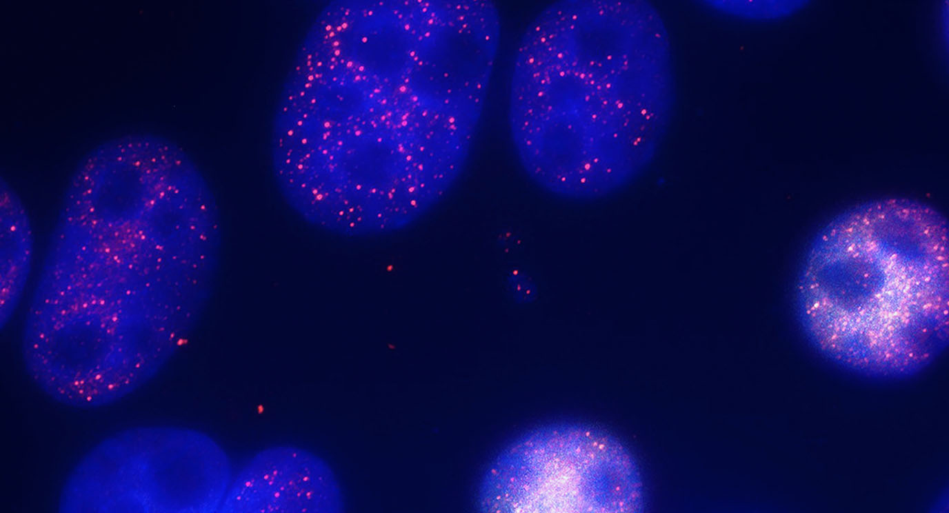 MD Anderson Research Highlights for June 30, 2021 | UT MD Anderson