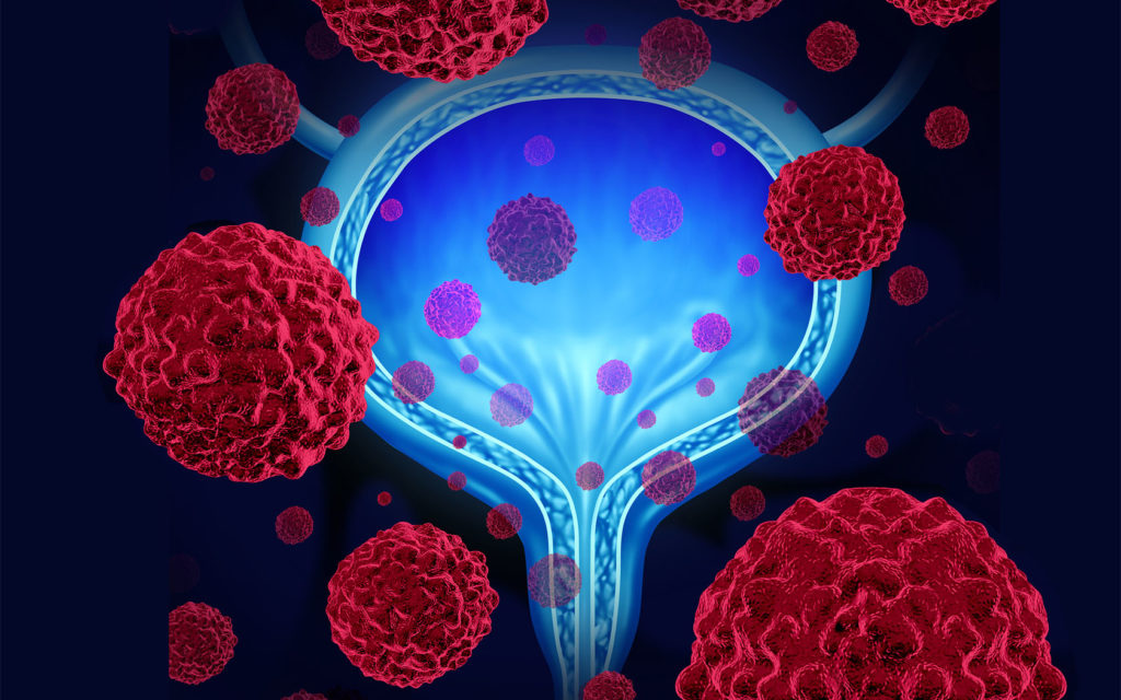 Ipilimumab and nivolumab immunotherapy combination produces high ...