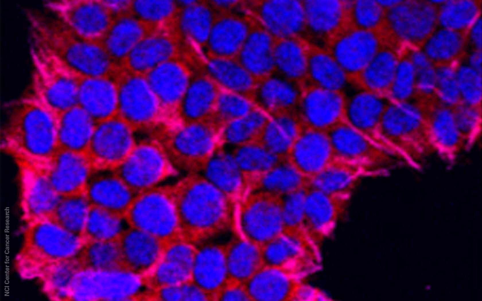 Stand Up to Cancer funds innovative approach to pancreatic cancer | MD ...