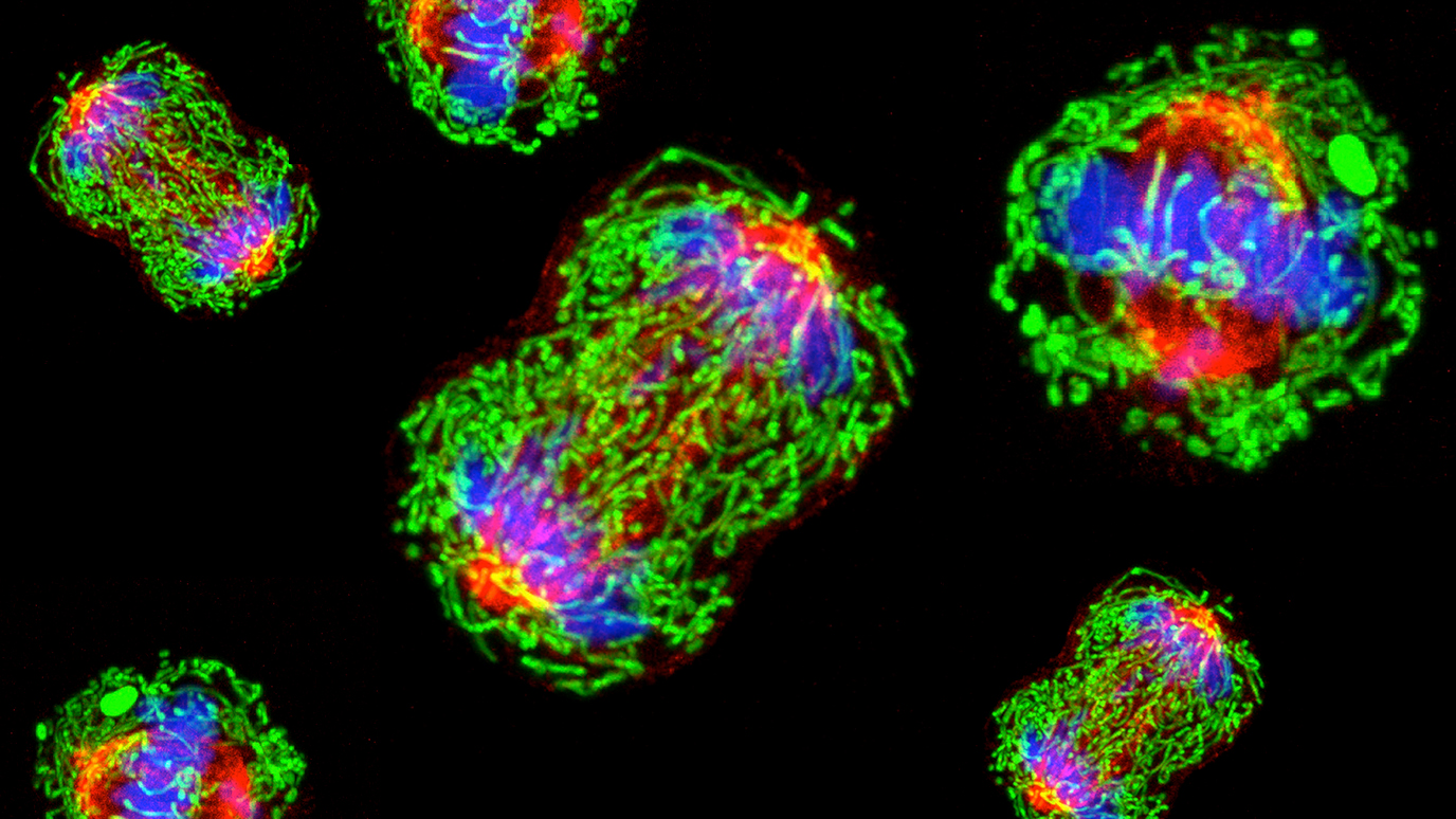 Triple negative breast cancers can adopt reversible state that is ...