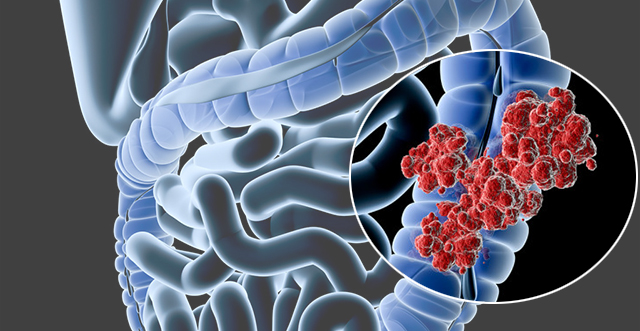 Study points to new strategy for boosting immunotherapy effectiveness ...