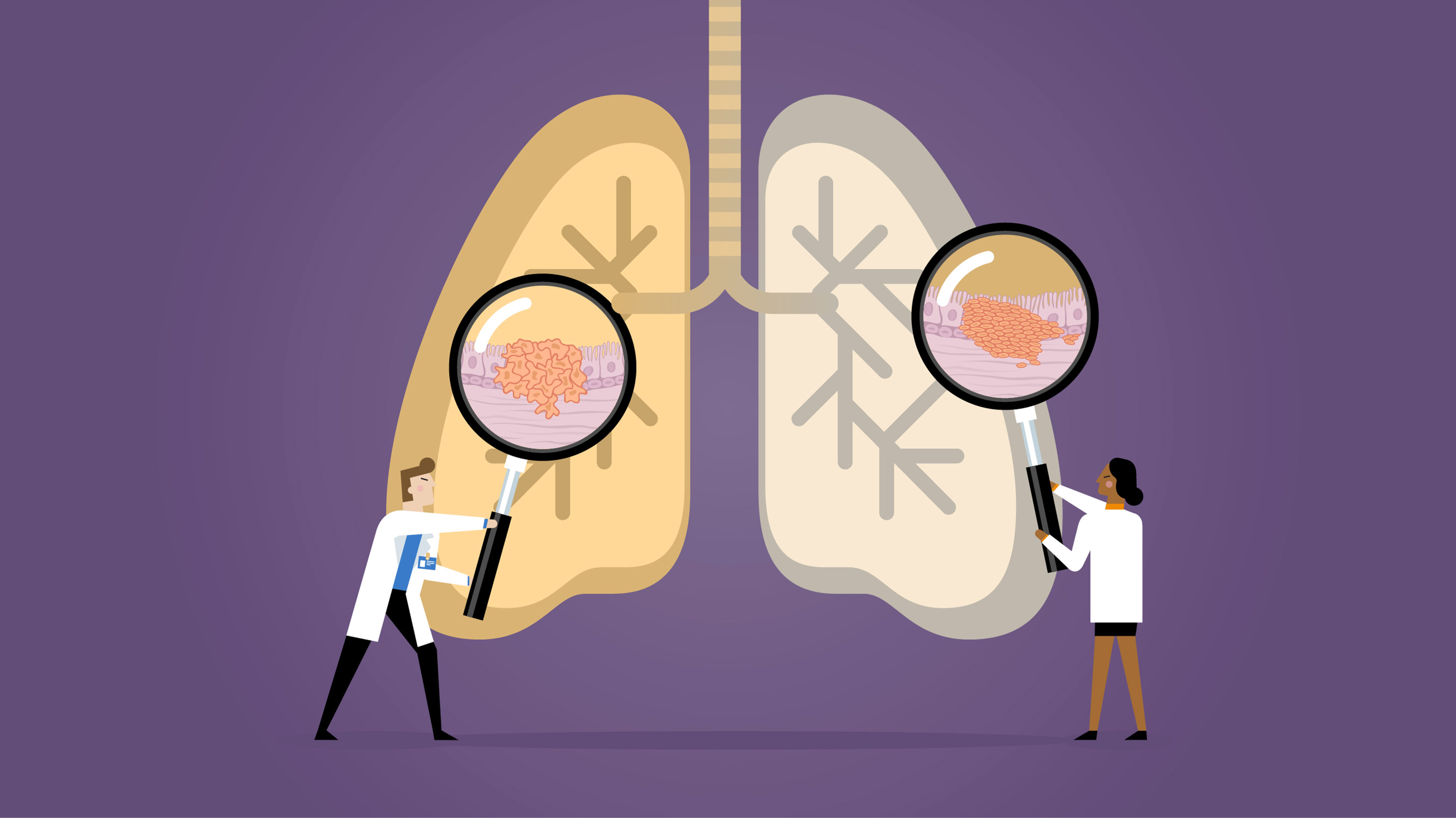Non Smoker Lungs Vs Smoker Non Smoker Lungs Vs Smoker