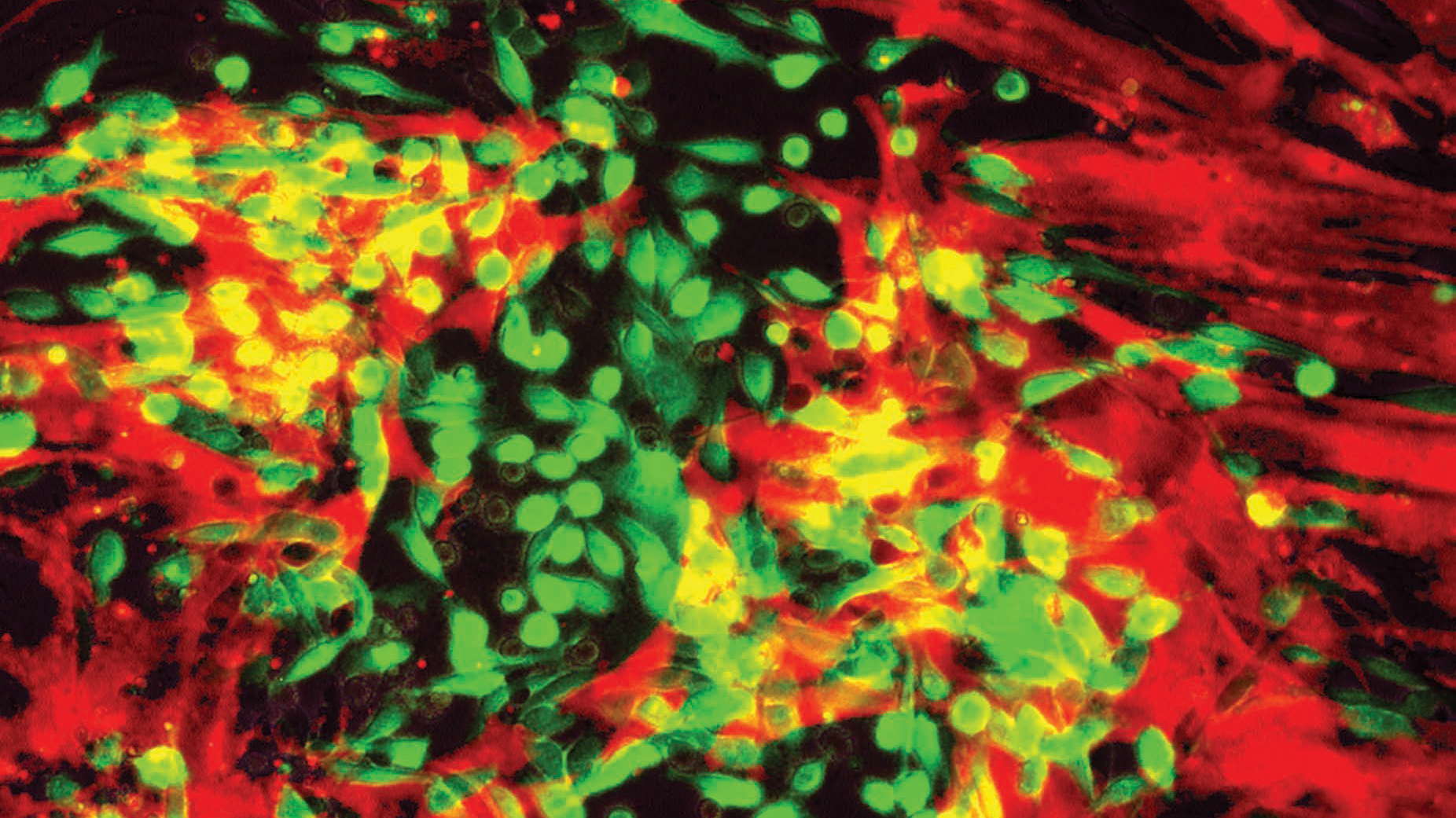 MD Anderson and Affimed announce clinical immuno-oncology development ...