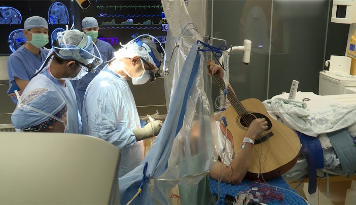 MD Anderson brain cancer patient plays guitar while doctors operate ...