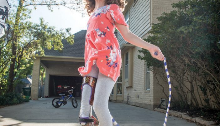 Rotationplasty turns an ankle into a knee | MD Anderson Cancer Center