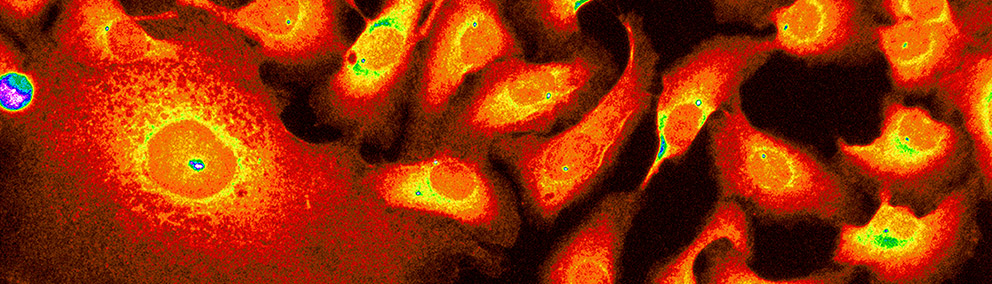 Md Anderson Houston Methodist Scientists Detect New Ovarian Cancer